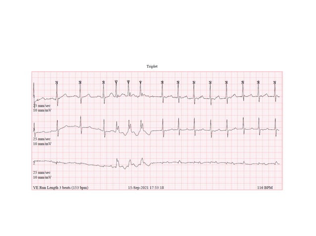 Reading and interpreting Holter2023.pptx