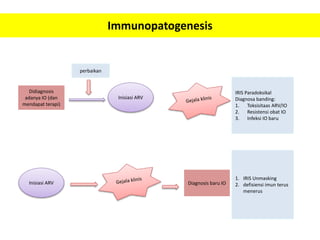 IMMUNE RECONSTITUTION INFLAMMATORY SYNDROME iris | PPTX