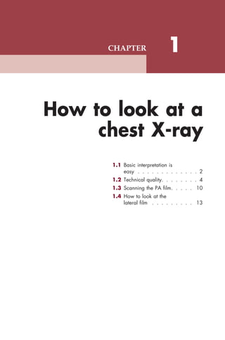 Reading chestxray | PDF