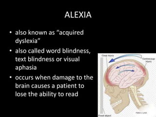 Reading disability-LET Review | PPTX