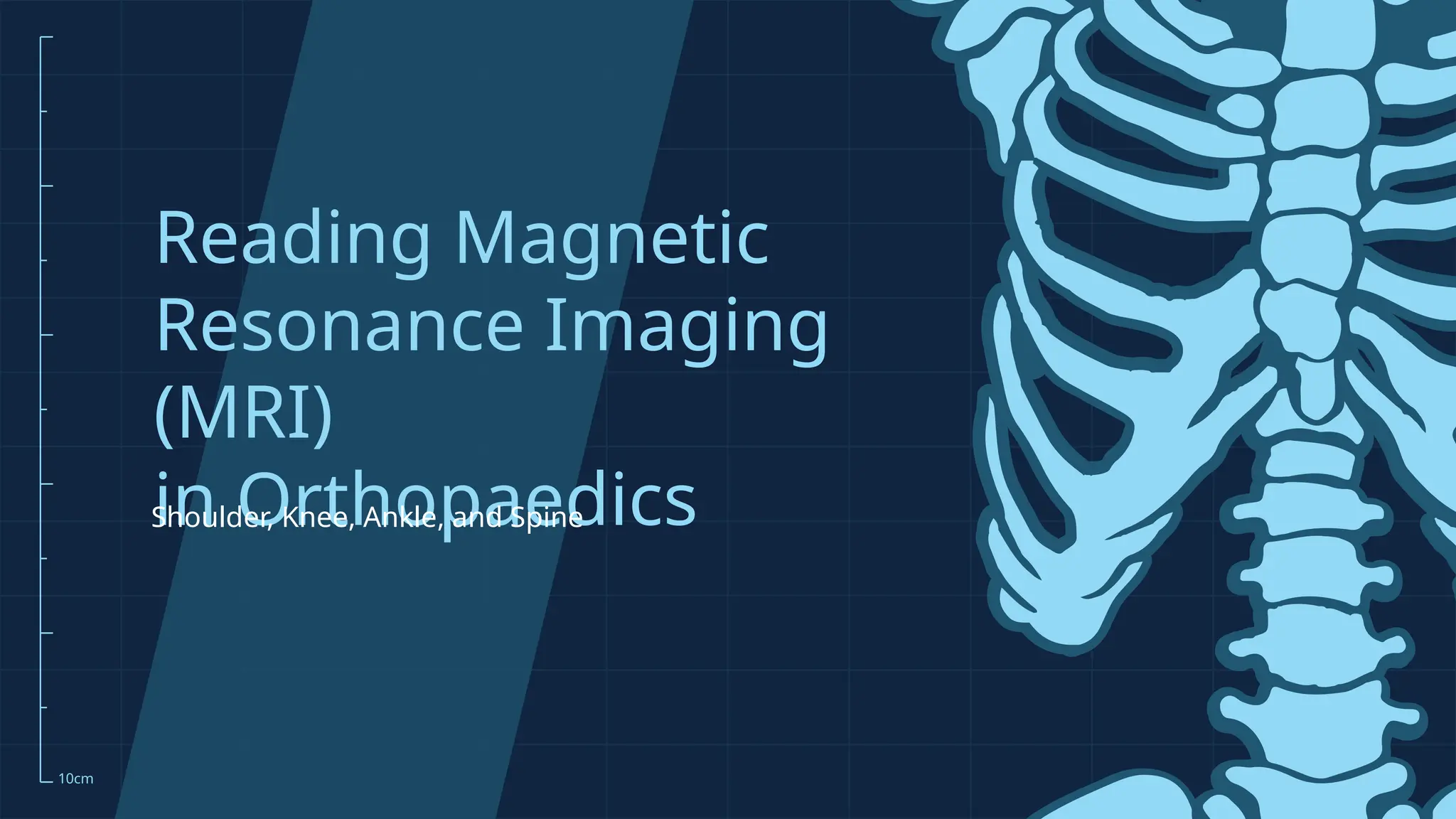 Reading Magnetic Resonance Imaging (MRI) in Orthopaedics | PPT