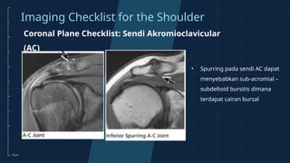 Reading Magnetic Resonance Imaging (MRI) in Orthopaedics | PPTX