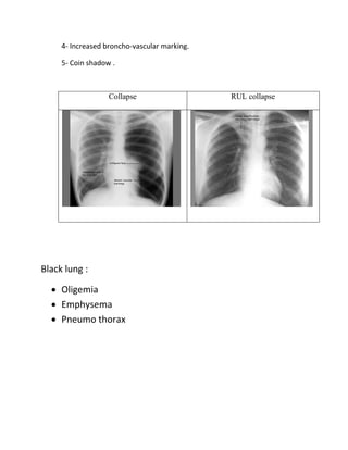 Chest X ray in 10 seconds | PDF