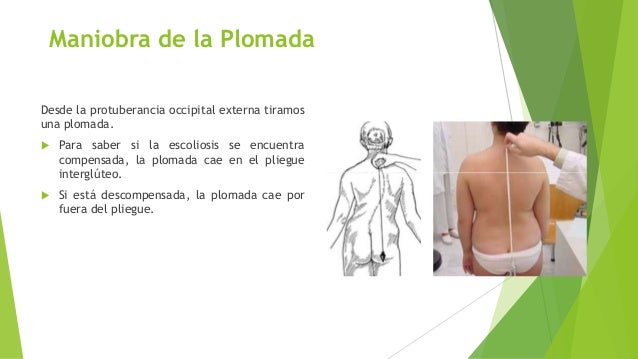 Presentación caso clínico Escoliosis