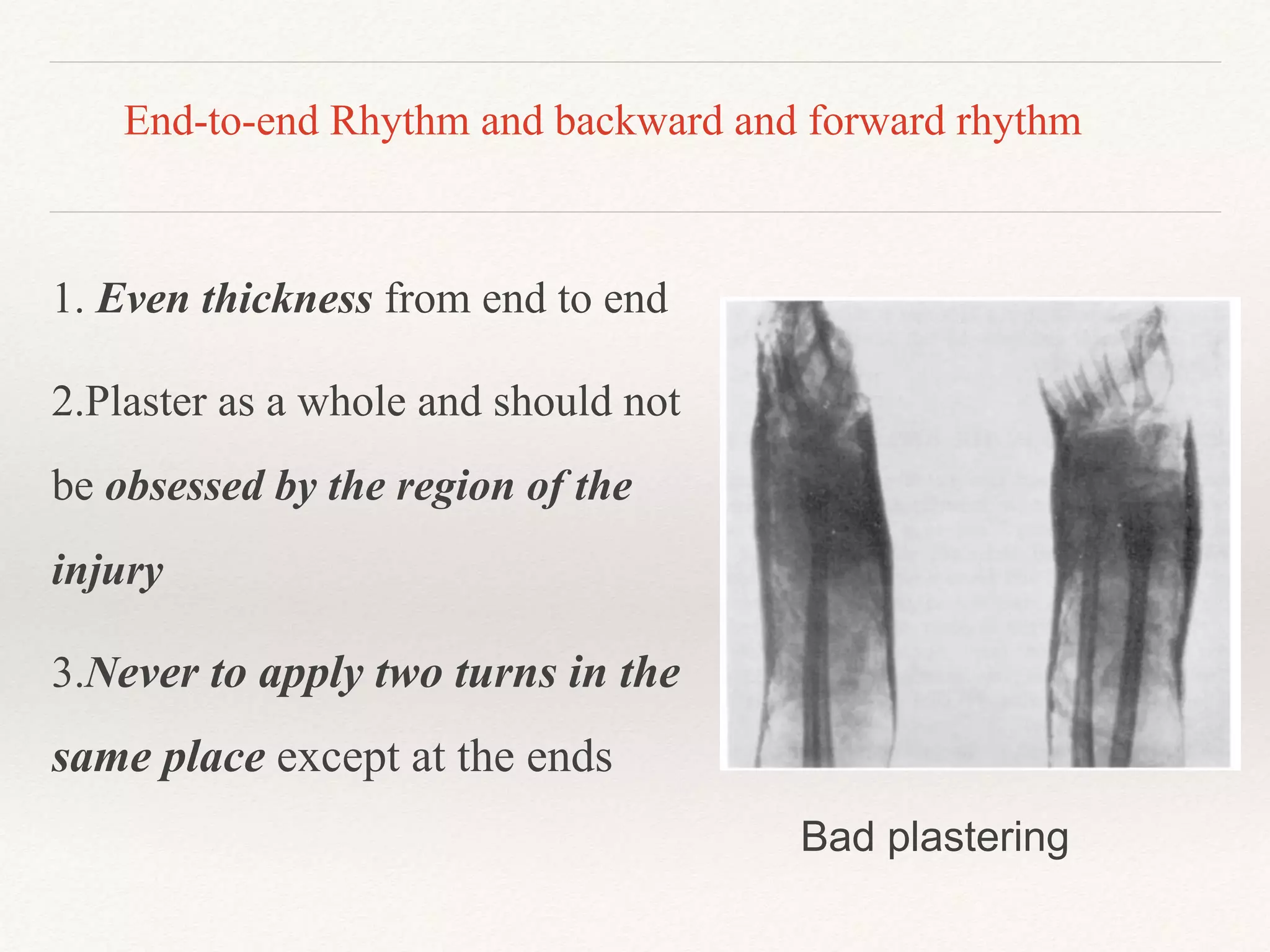 Plaster of paris in orthopaedics | PPSX