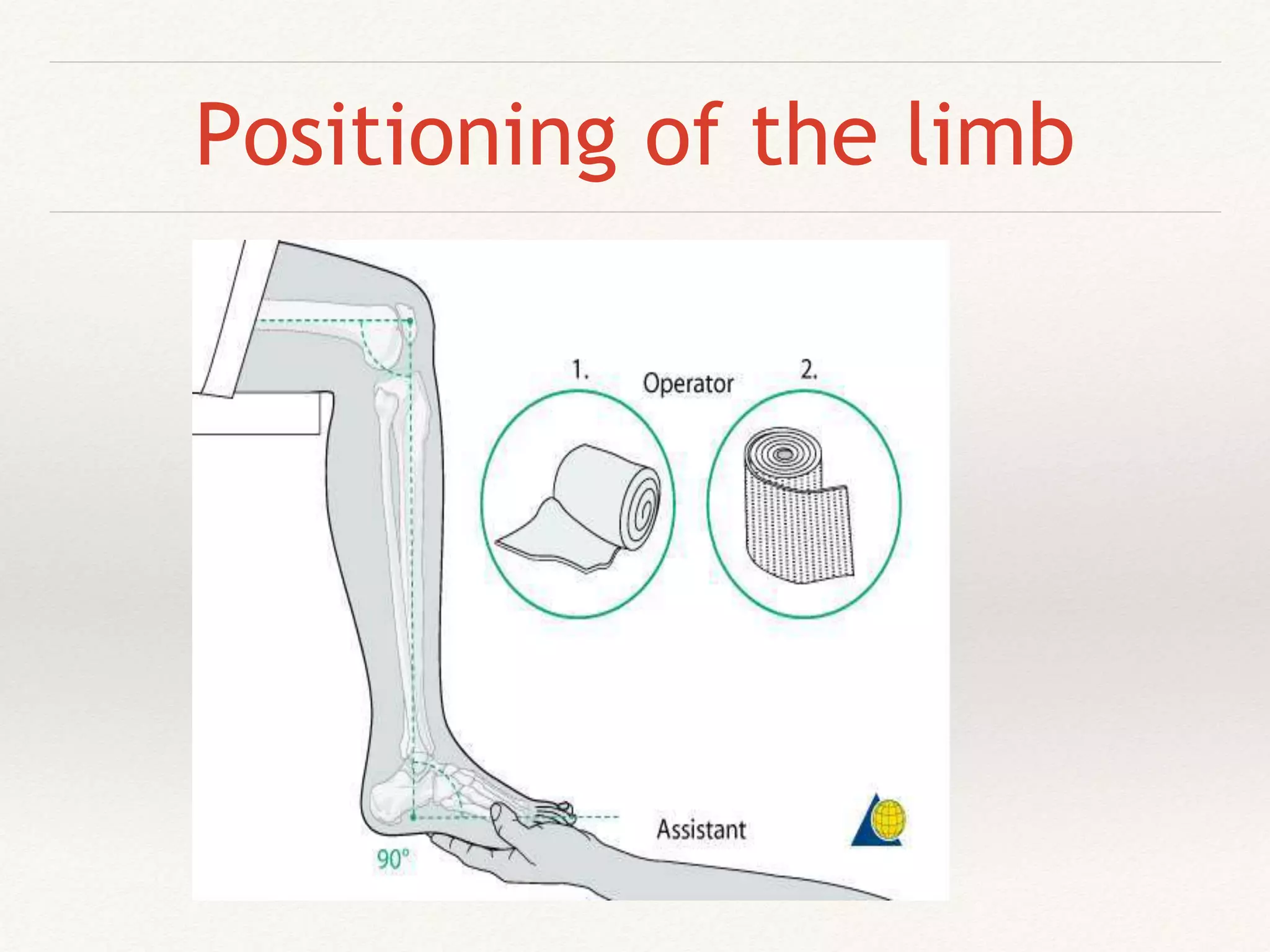 Plaster of paris in orthopaedics | PPSX