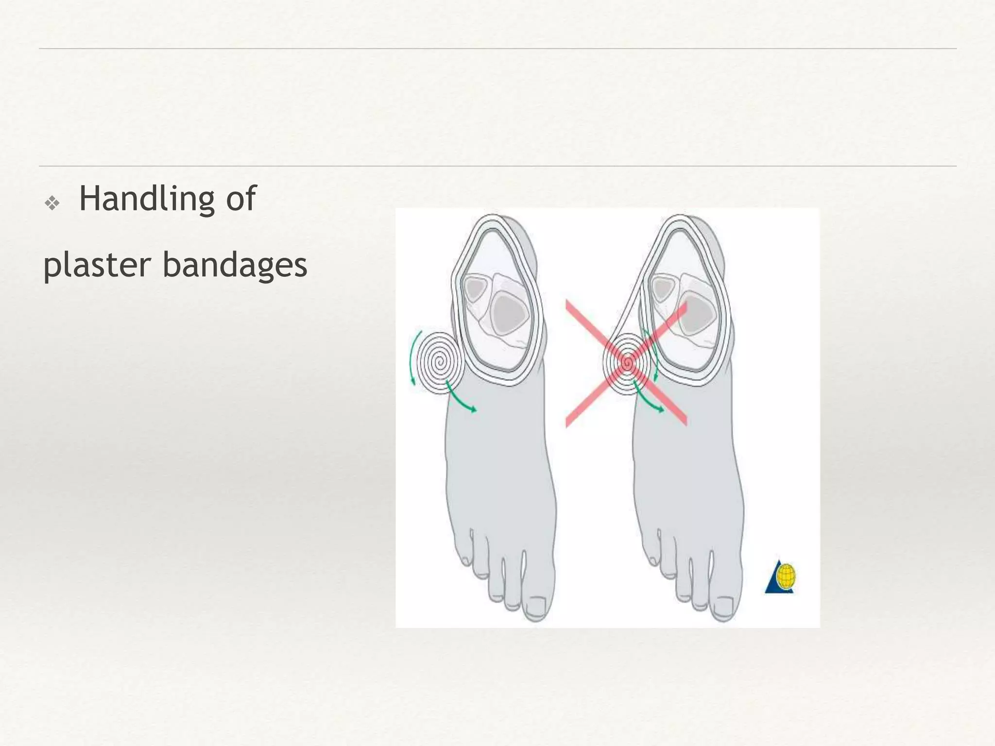 Plaster of paris in orthopaedics | PPSX