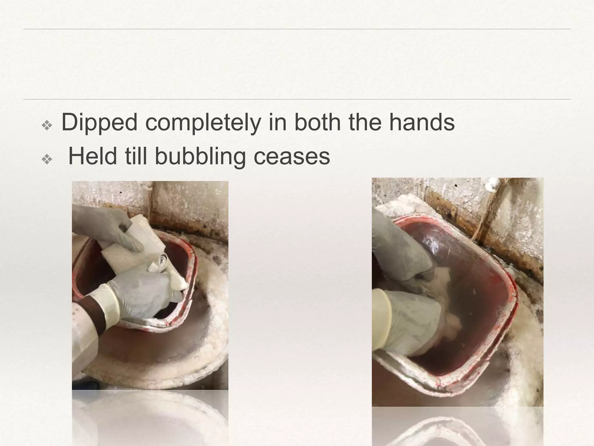 Plaster of paris in orthopaedics | PPSX