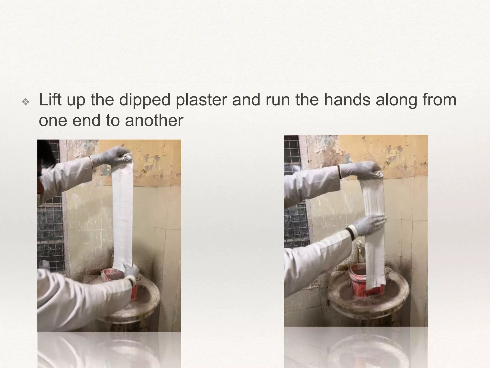 Plaster of paris in orthopaedics | PPSX