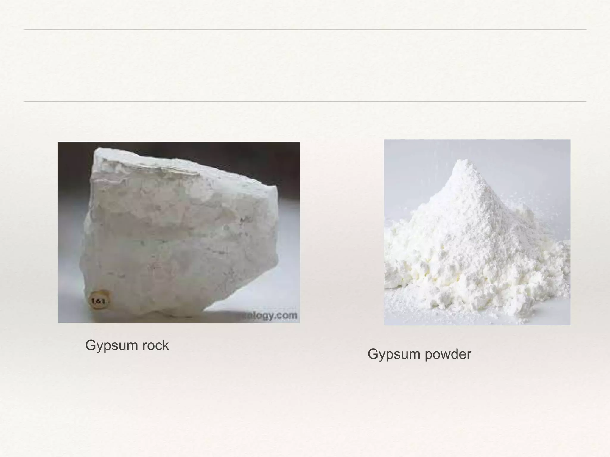 Plaster of paris in orthopaedics | PPSX