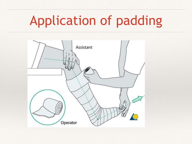 Plaster of paris in orthopaedics | PPSX