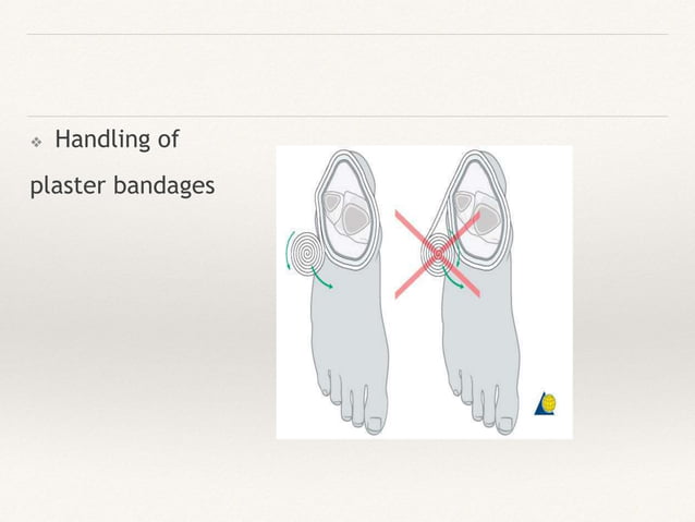 Plaster of paris in orthopaedics | PPSX