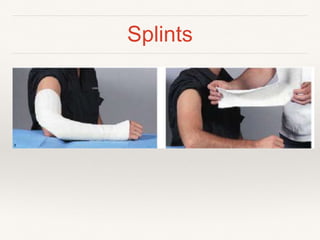 Plaster of paris in orthopaedics | PPSX