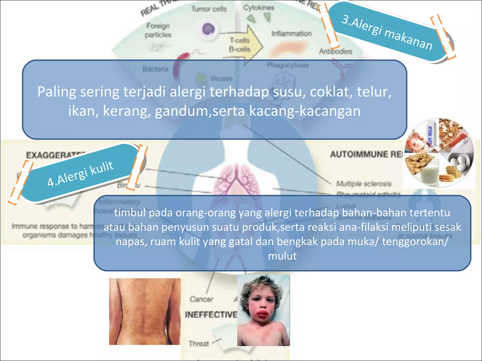 Reaksi alergi | PPT