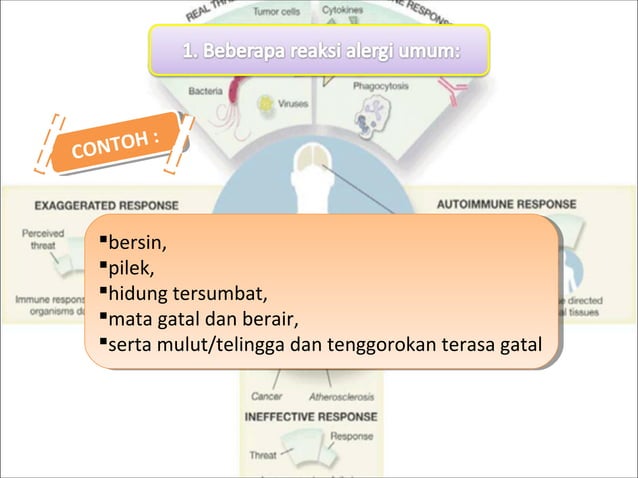Reaksi alergi | PPT