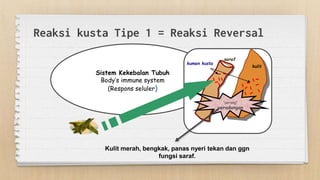 Reaksi Kusta | PPTX