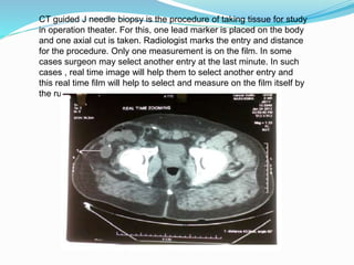 Digital X-ray Problems.. | PPSX