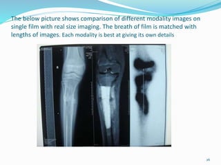 Digital X-ray Problems.. | PPSX