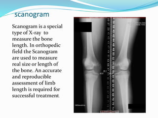 Digital X-ray Problems.. | PPSX