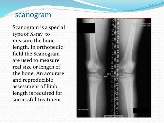 Digital X-ray Problems..