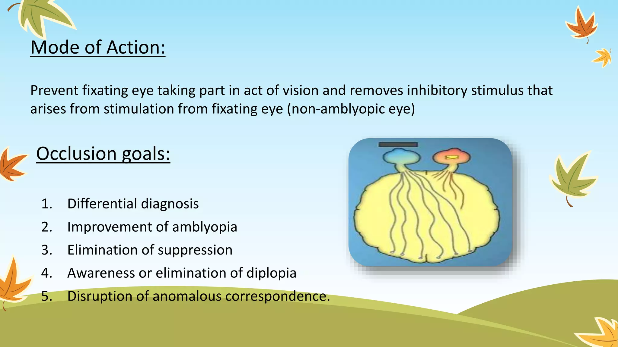 Real active and passive therapy in amblyopia managament | PPTX