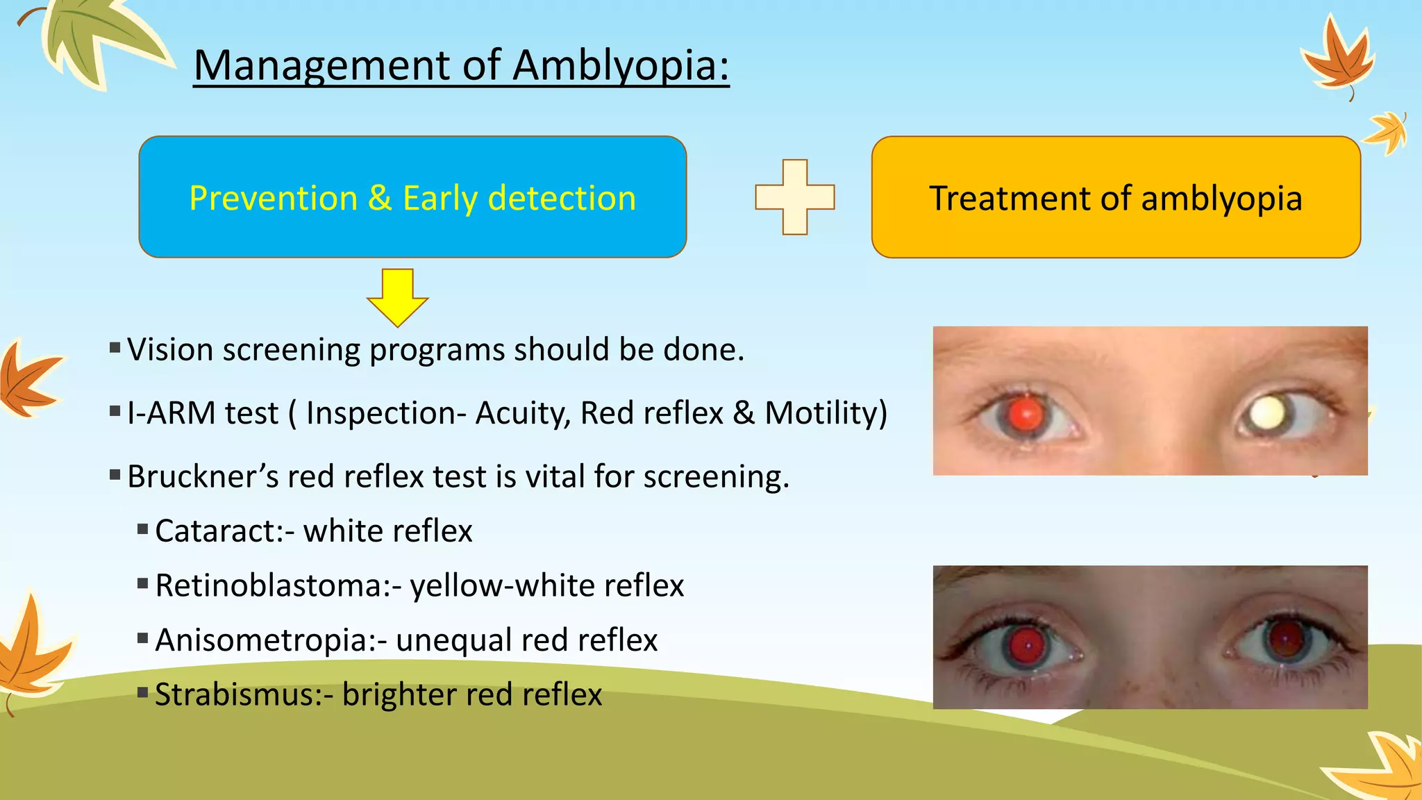 Real active and passive therapy in amblyopia managament | PPTX