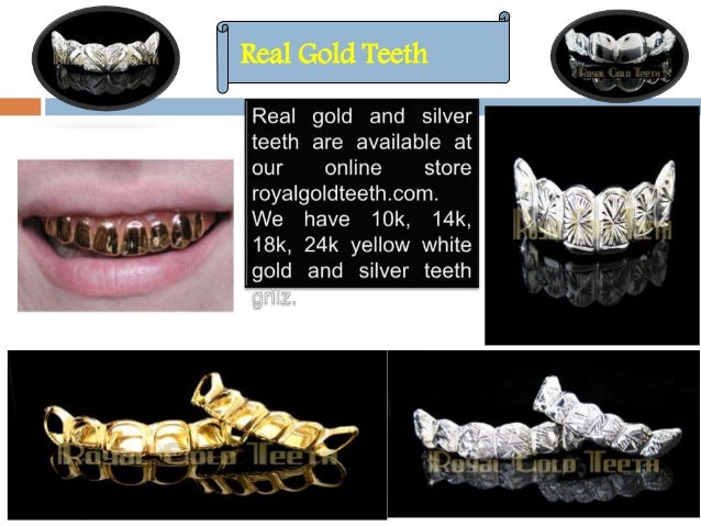 Real gold and silver teeth