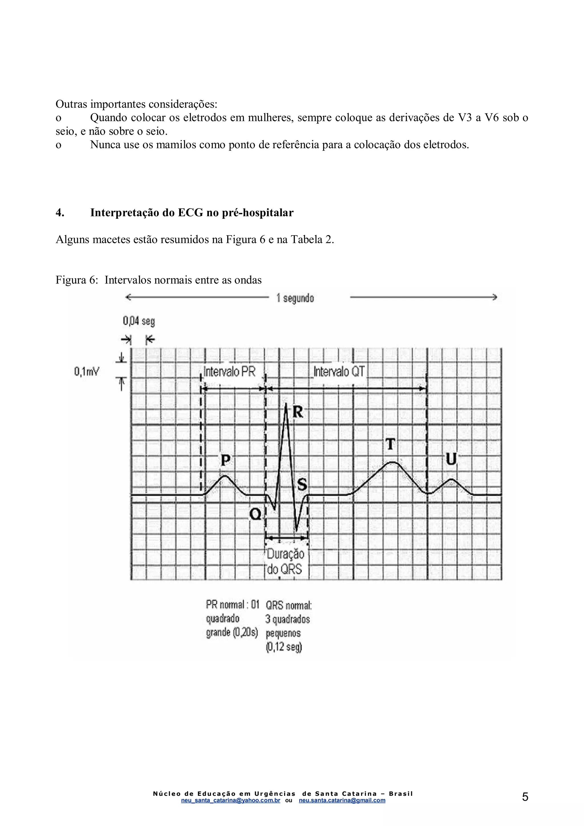 Realizacao e interpretacao do ecg no pre hospitalar | PDF
