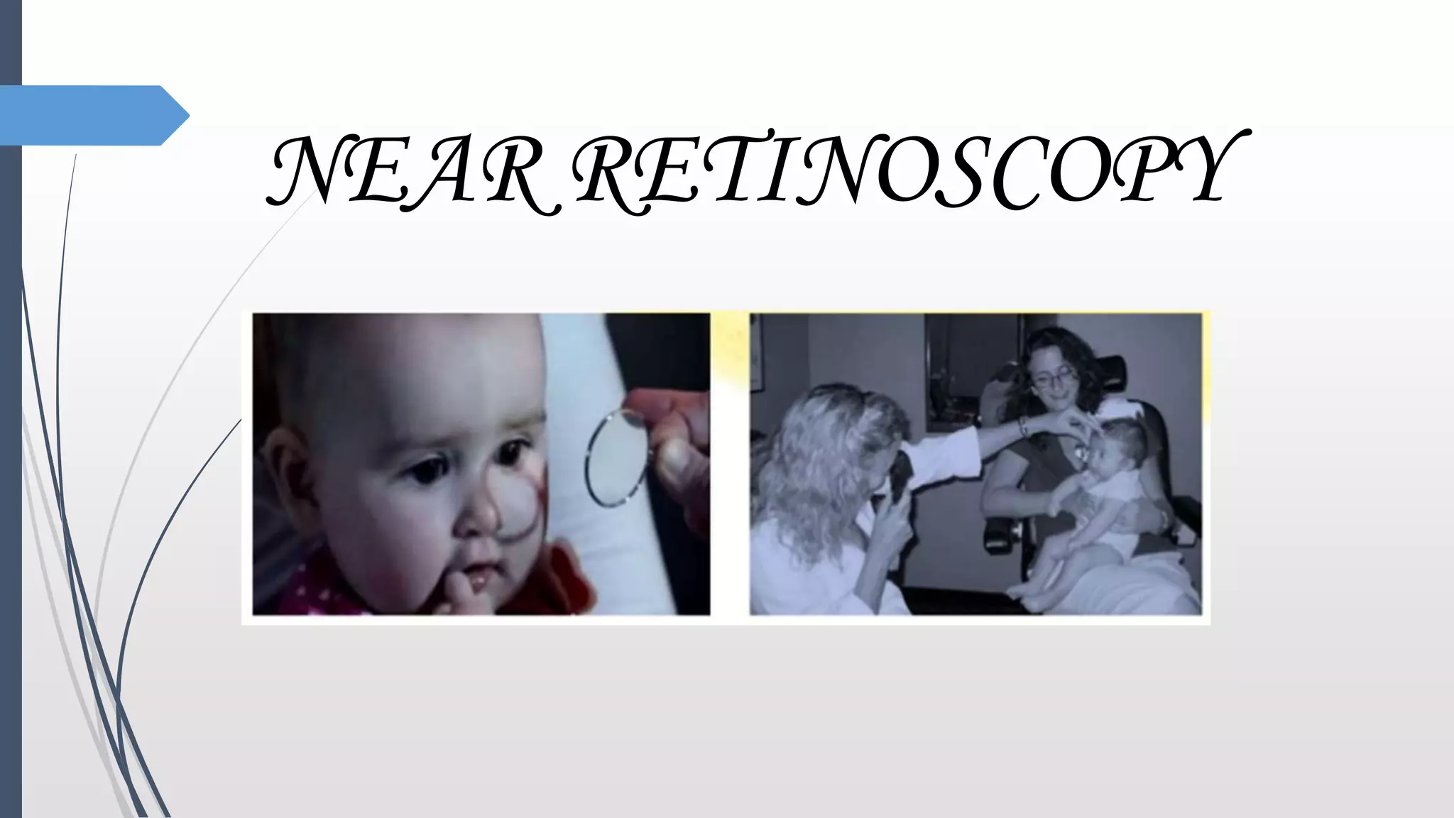 Real pediatric refraction and spectacle power prescription in ...