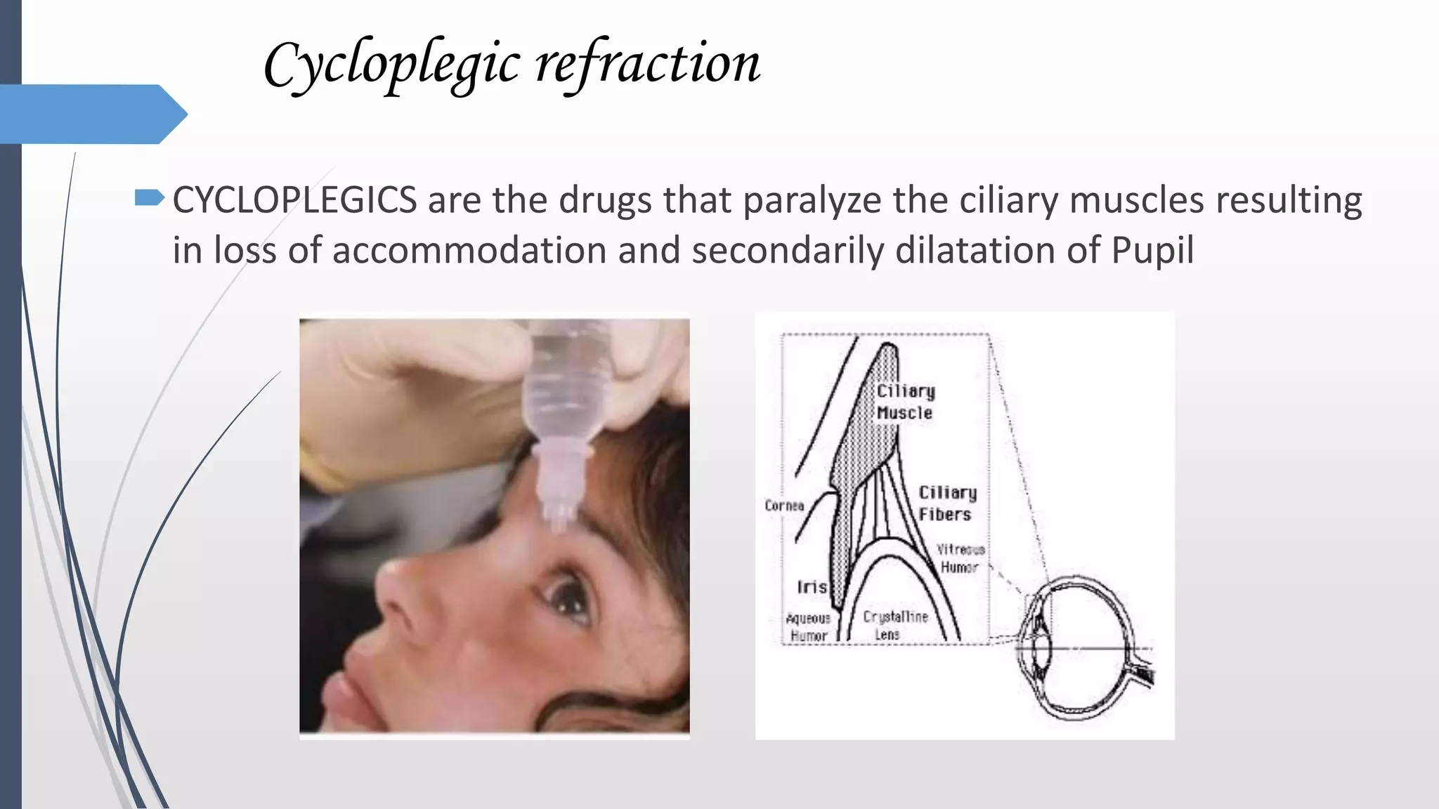 Real pediatric refraction and spectacle power prescription | PPTX