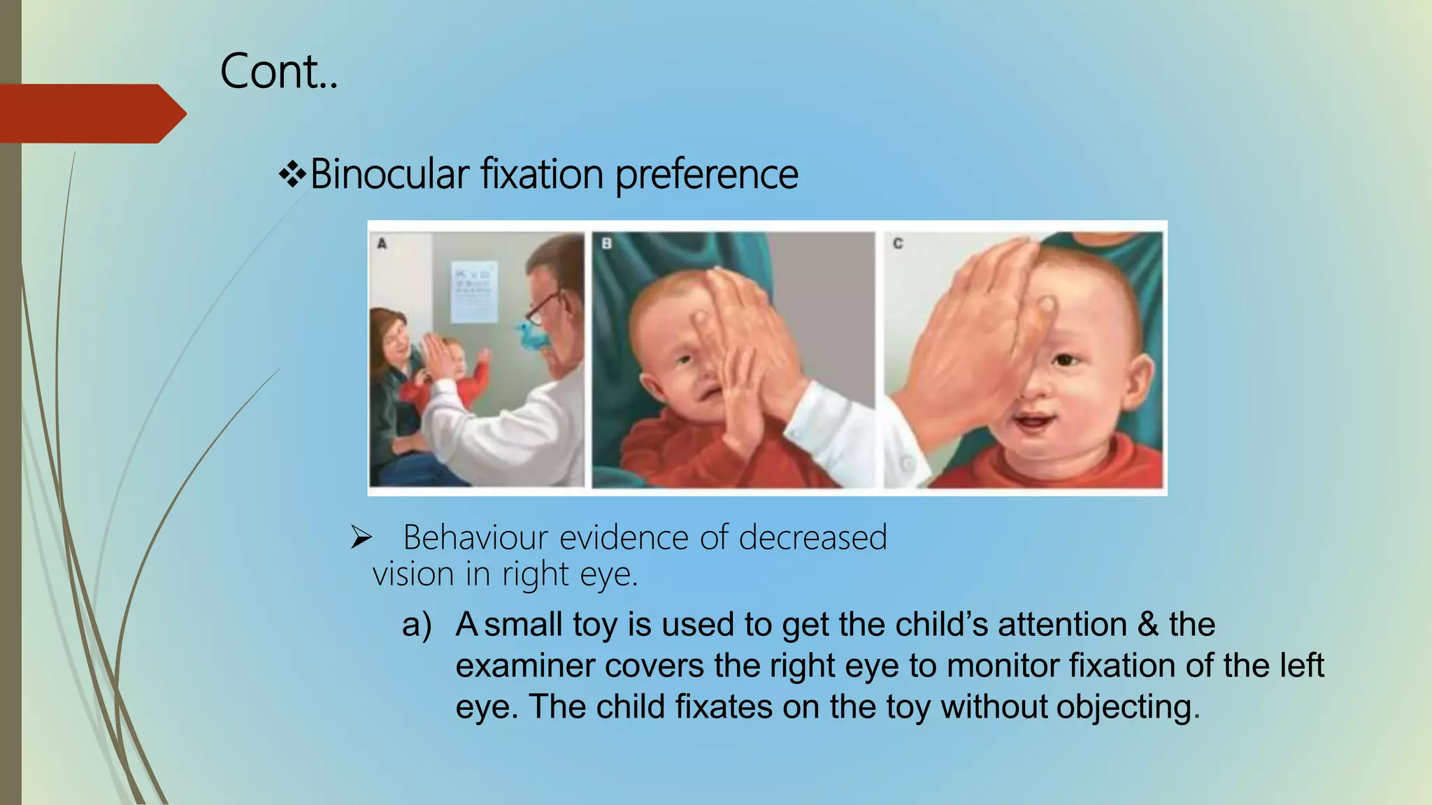 Real pediatric visual acuity assessment | PPTX