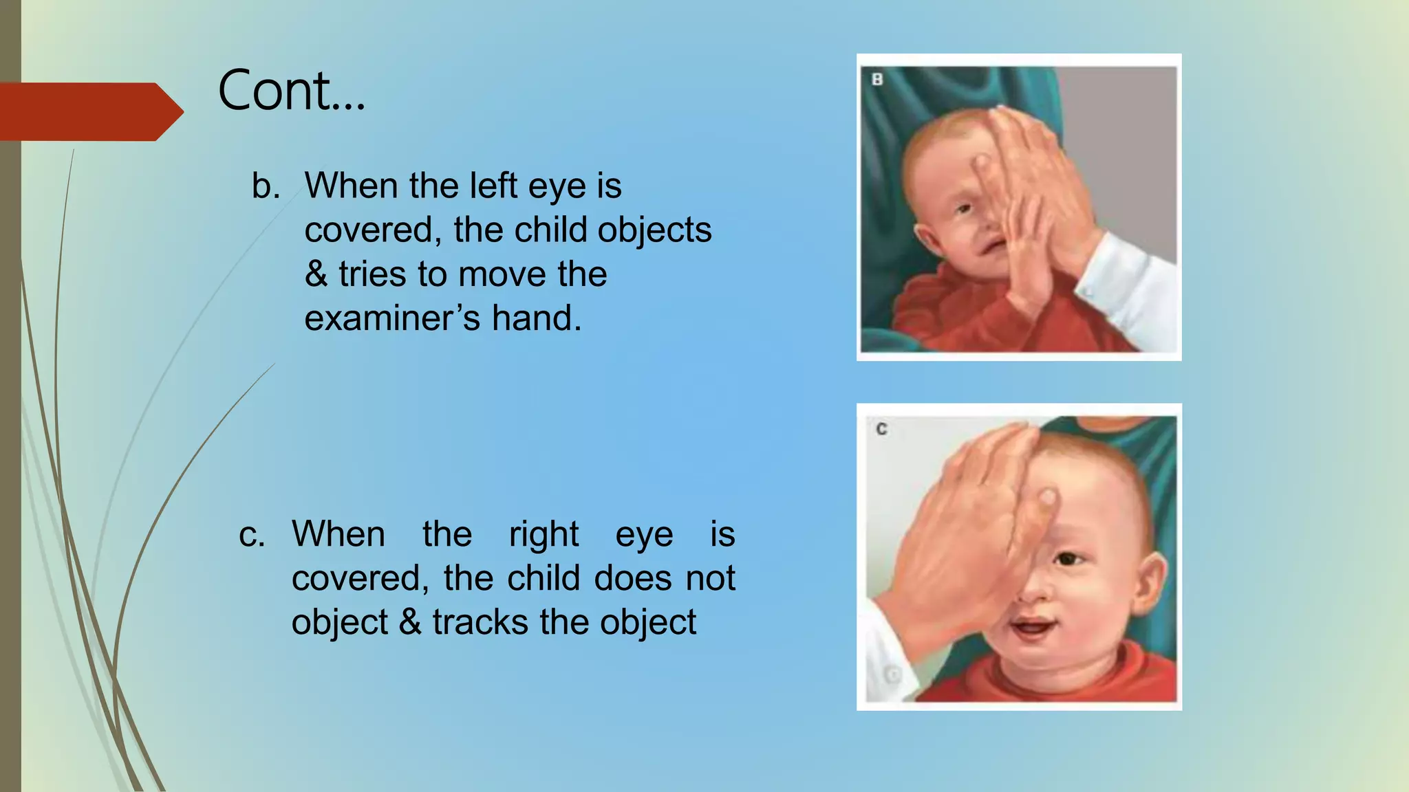 Real pediatric visual acuity assessment | PPTX