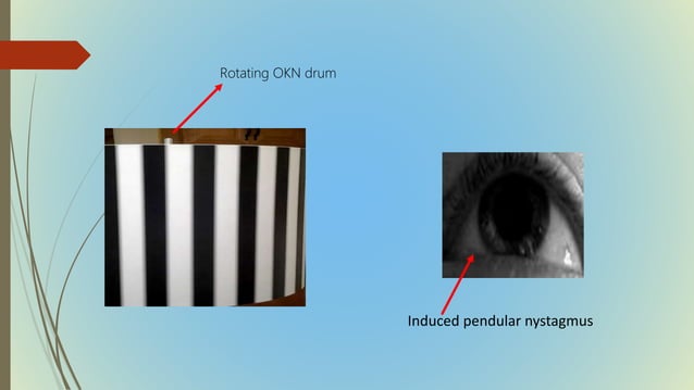 Real pediatric visual acuity assessment | PPTX