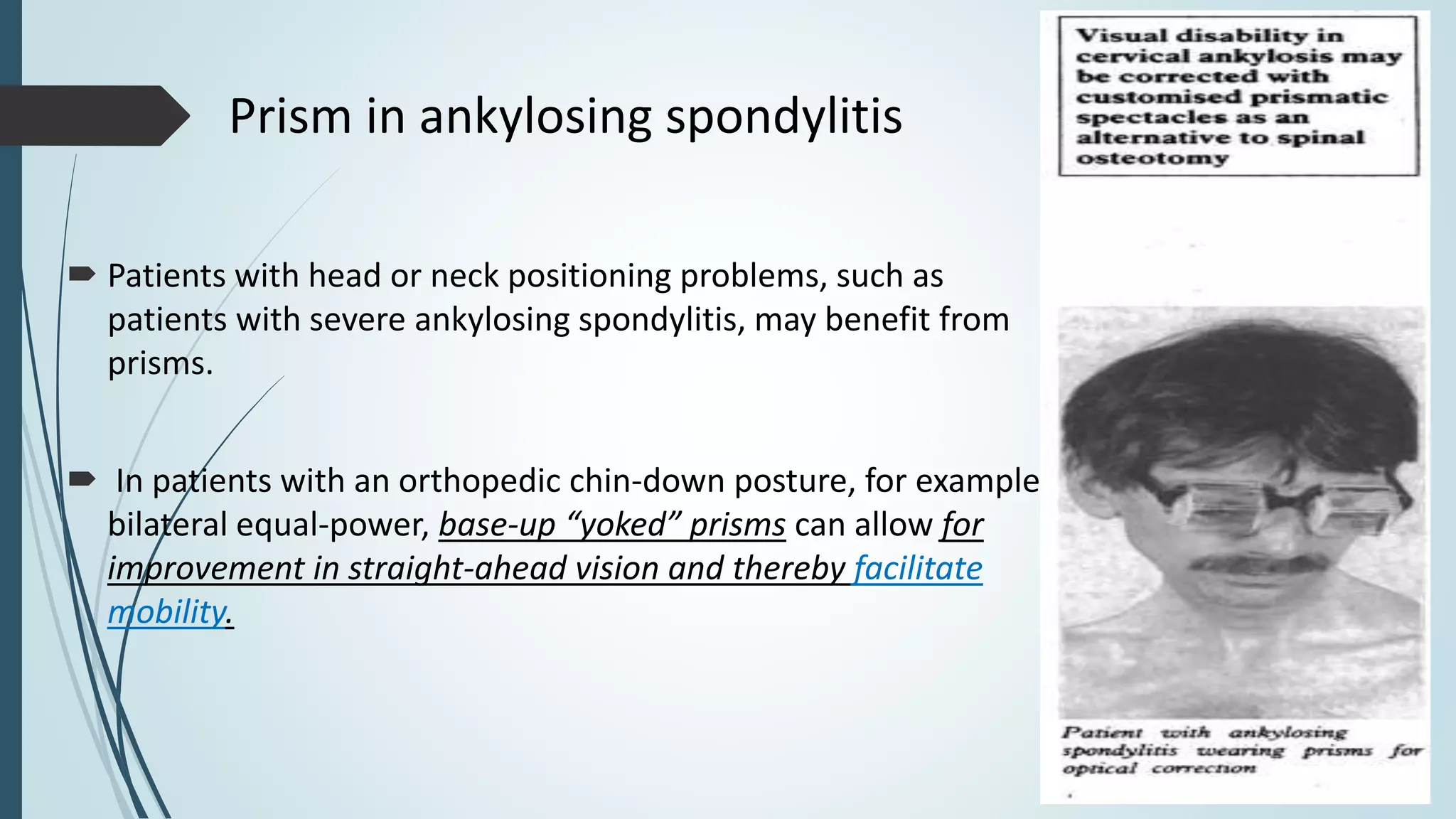 Real prism use in ophthalmology | PPTX