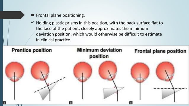 Real prism use in ophthalmology | PPTX