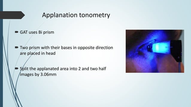 Real prism use in ophthalmology | PPTX