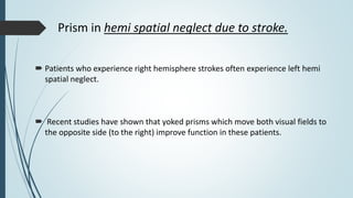 Real prism use in ophthalmology | PPTX
