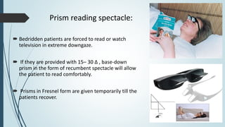 Real prism use in ophthalmology | PPTX