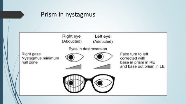 Real prism use in ophthalmology