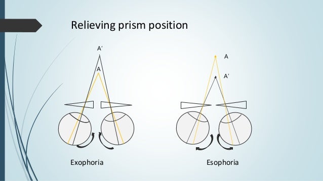 Real prism use in ophthalmology