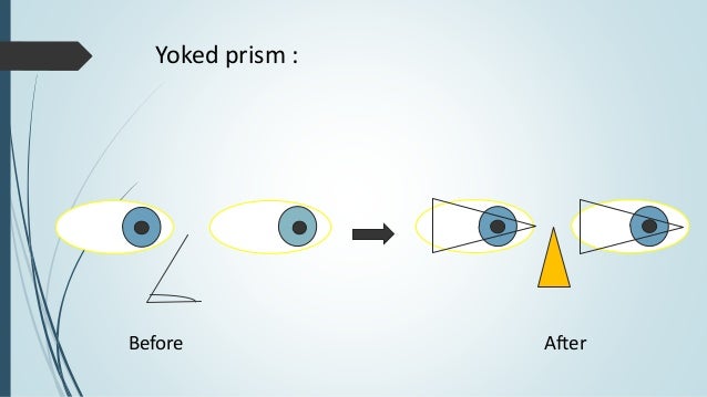Real prism use in ophthalmology