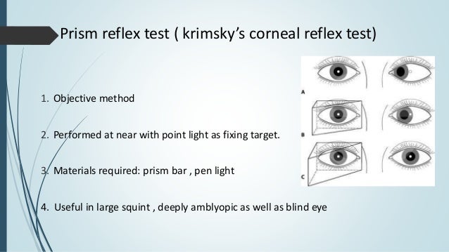 Real prism use in ophthalmology