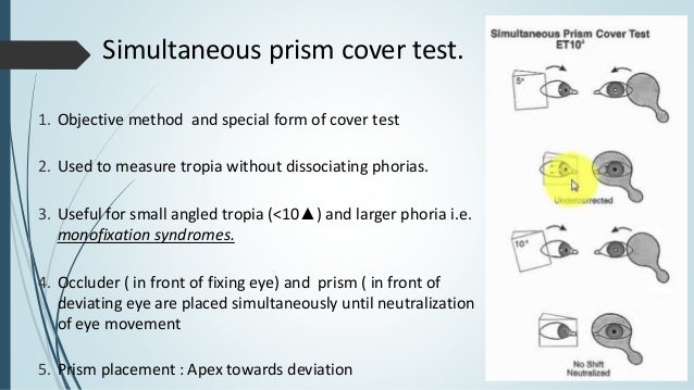 Real prism use in ophthalmology