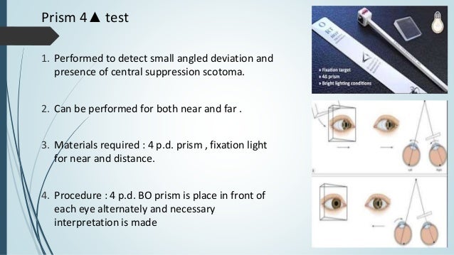 Real prism use in ophthalmology