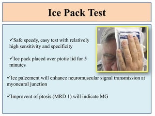 Real ptosis evaluation.pptx