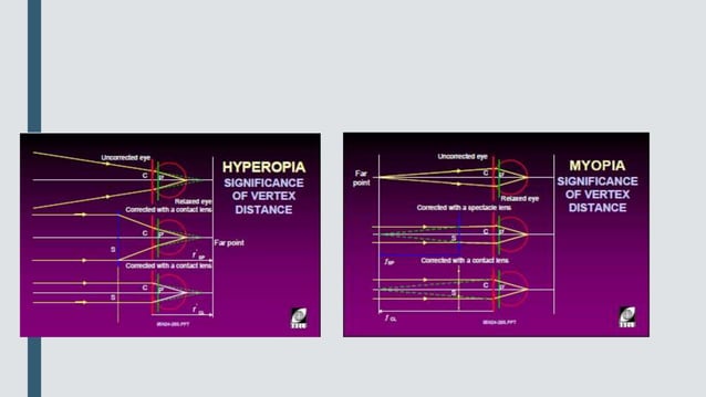 soft contact lens optics and soft contact lens materials | PPTX