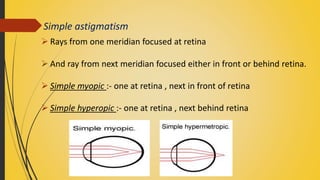 Real subjective refraction in astigmatism | PPTX