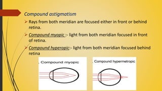 Real subjective refraction in astigmatism | PPTX