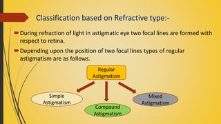 Real subjective refraction in astigmatism | PPTX
