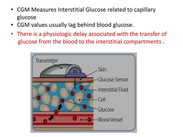 Real time continuous glucose monitoring | PDF